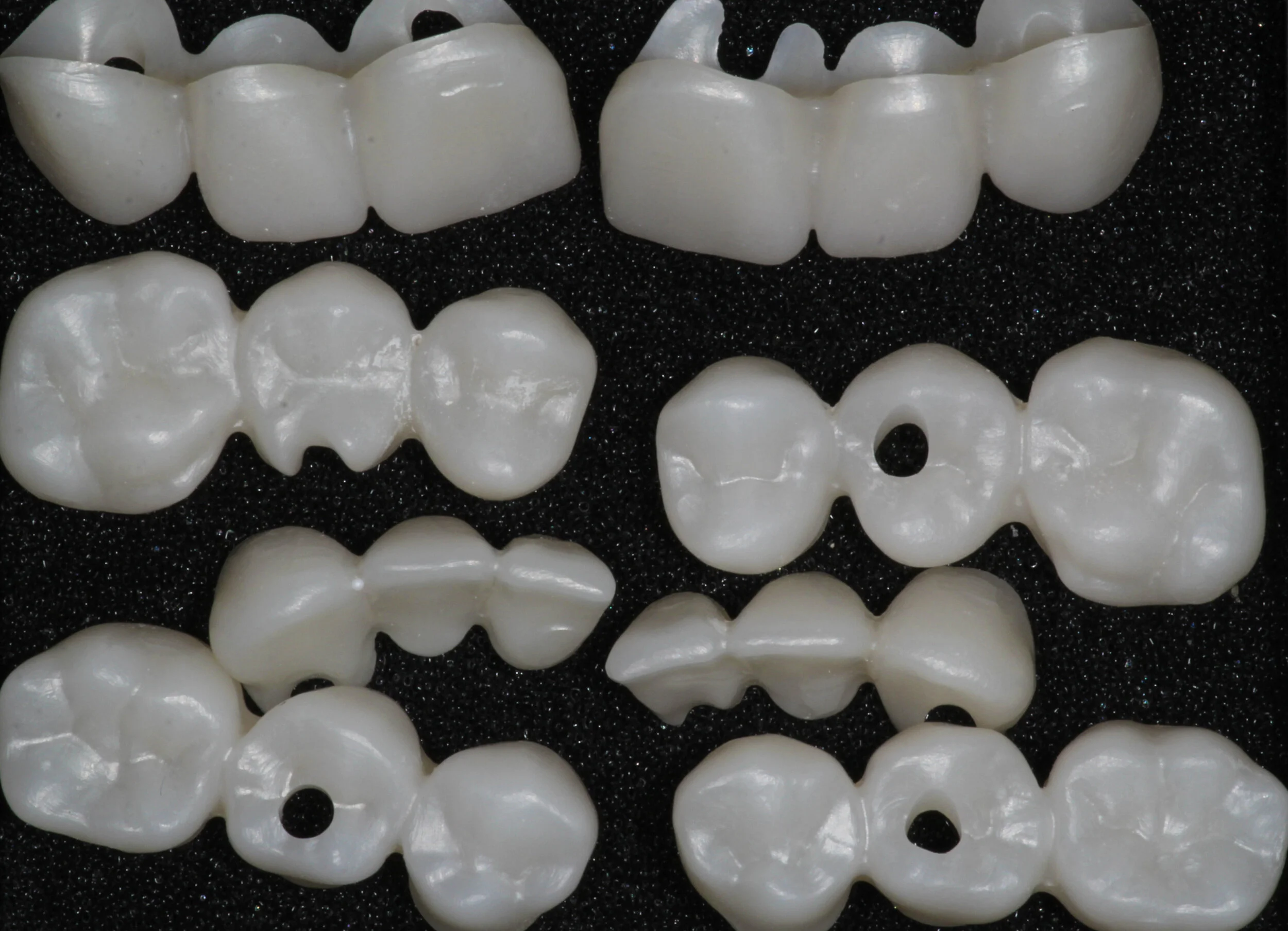 Restorations — SYNrG Lab