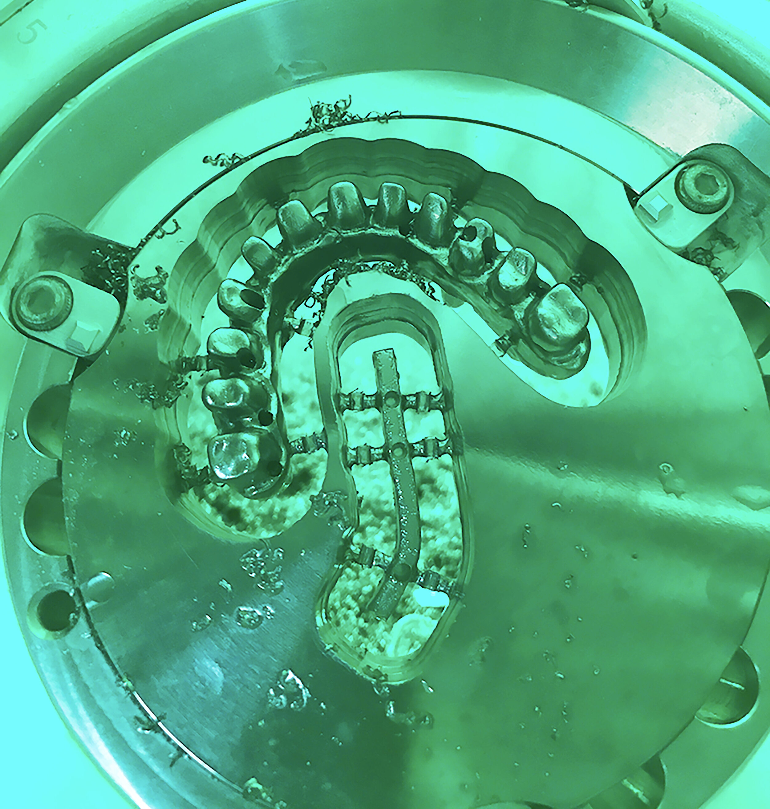 Restorations — SYNrG Lab