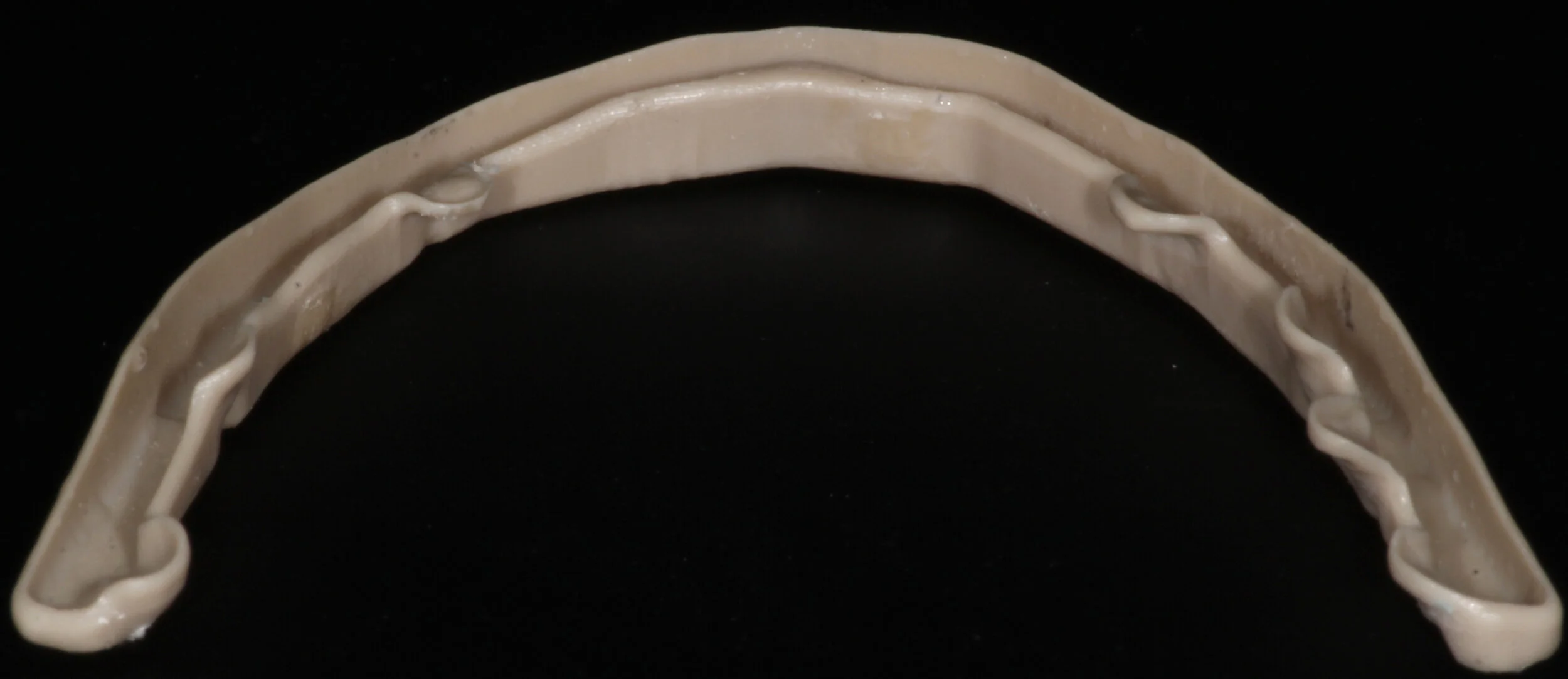 Restorations — SYNrG Lab