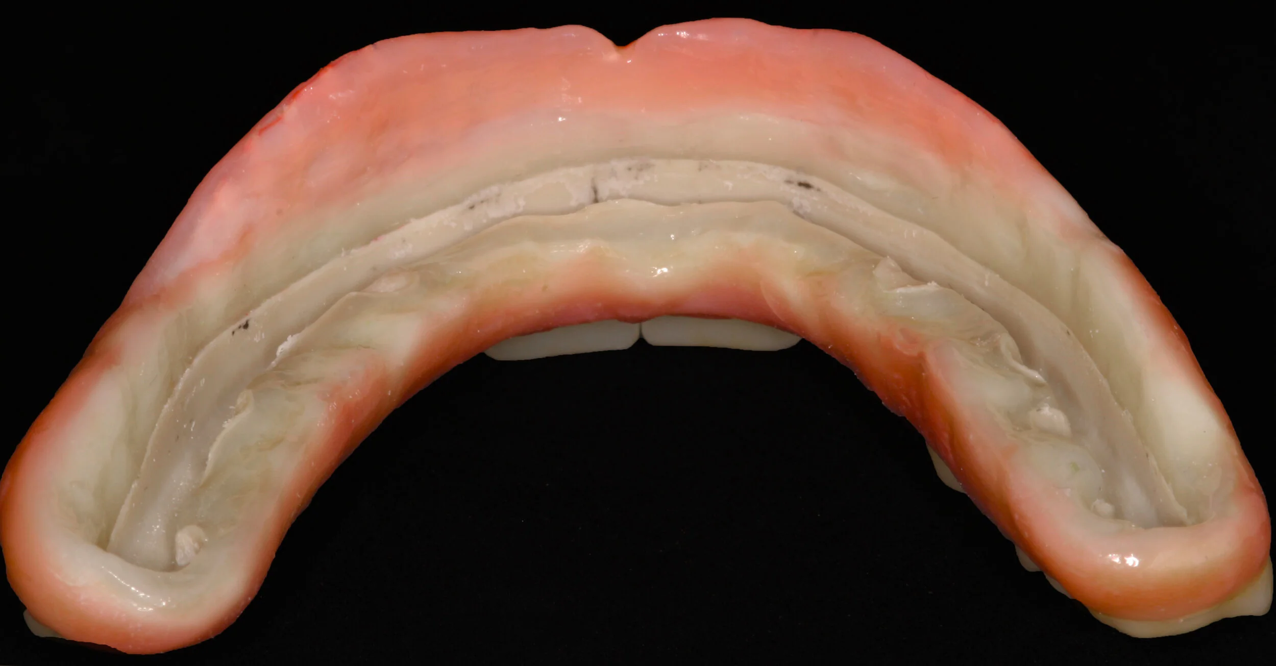 Restorations — SYNrG Lab