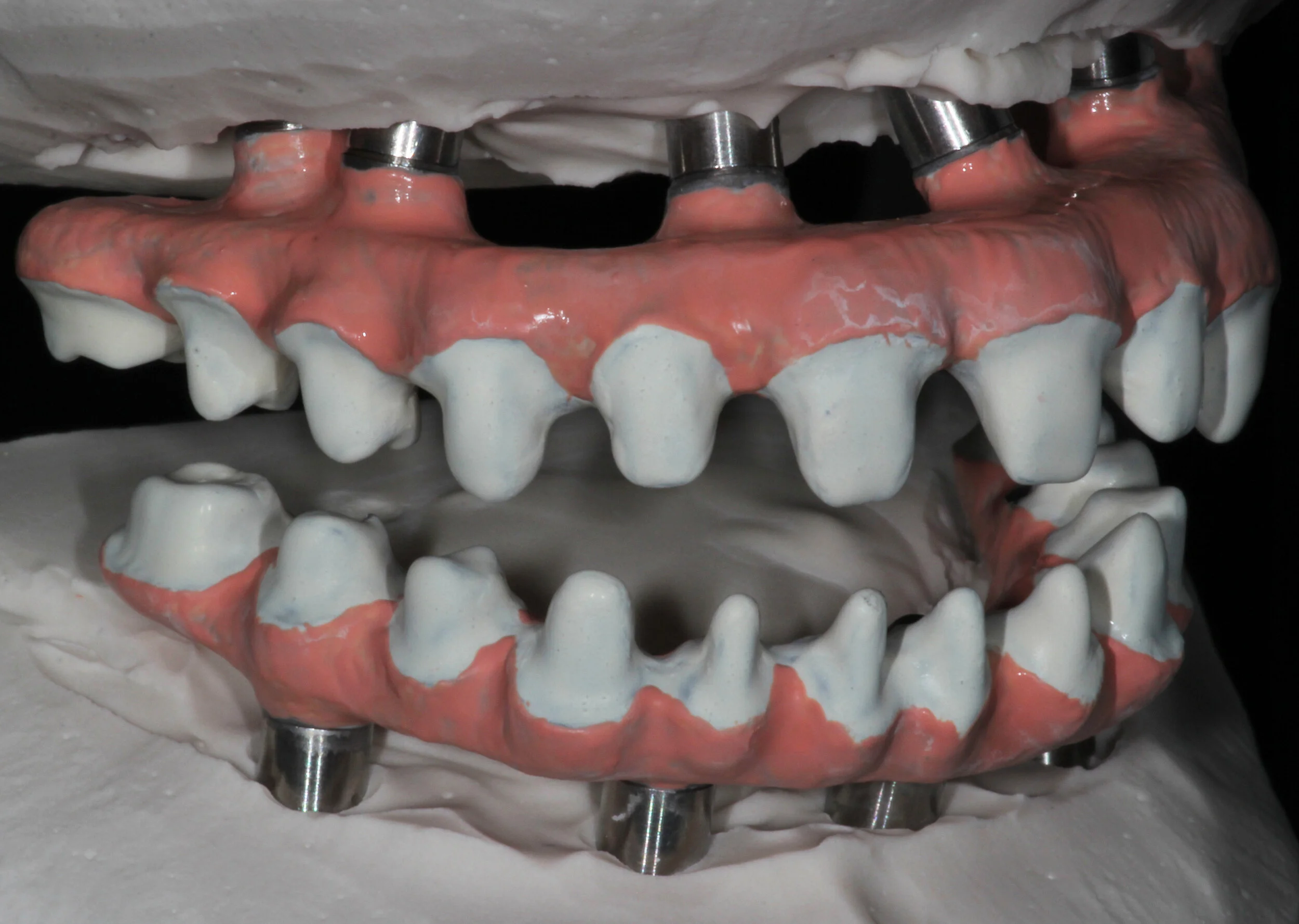 Restorations — SYNrG Lab