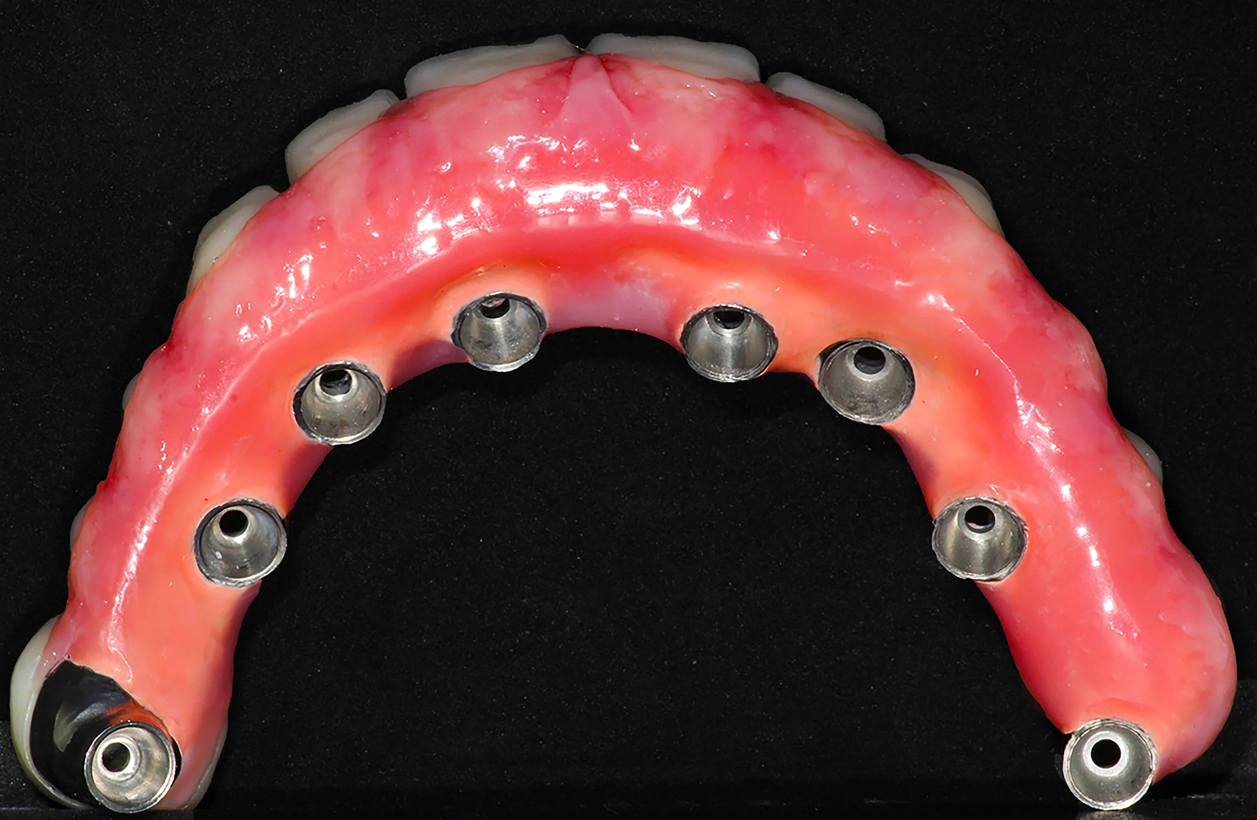 Restorations — SYNrG Lab