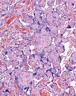 SUNY Downstate Pathology Residents