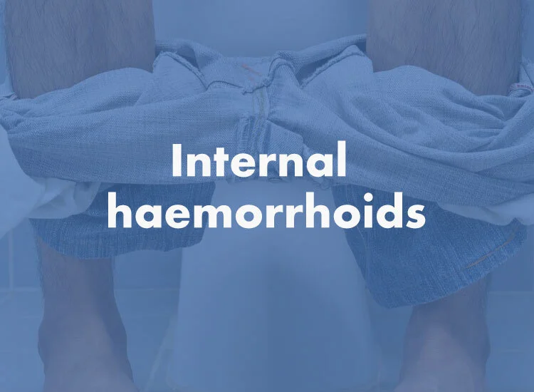 Hemorrhoids | Haemorrhoids | Piles | eXroid