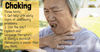 Choking and Older People | What to do if a person is choking