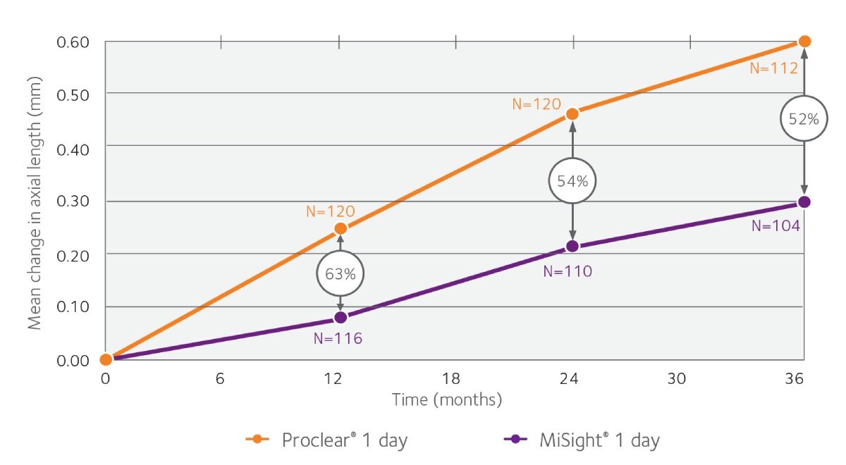 MiSight Contact Lenses Review: How They Work & More