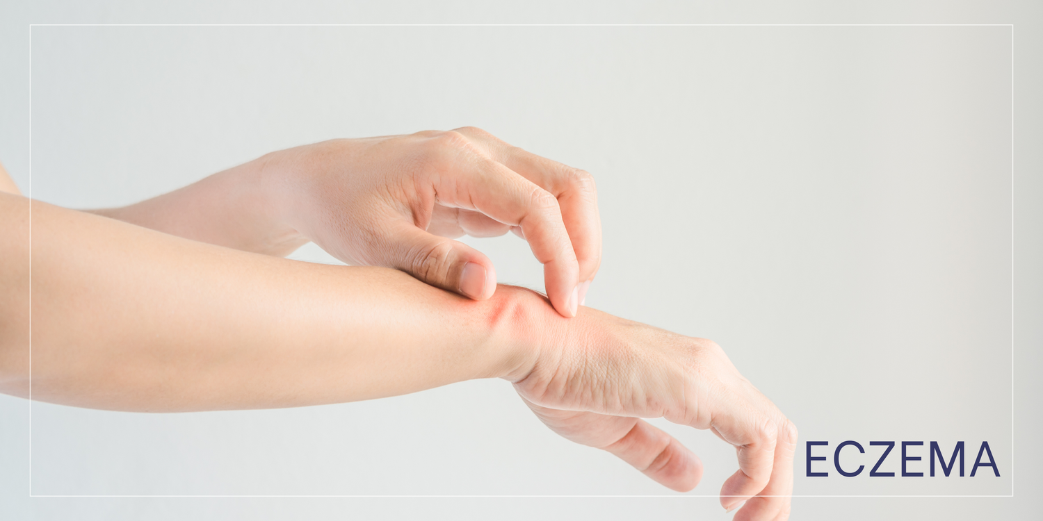 Eczema — Georgia Dermatology & Skin Cancer Center