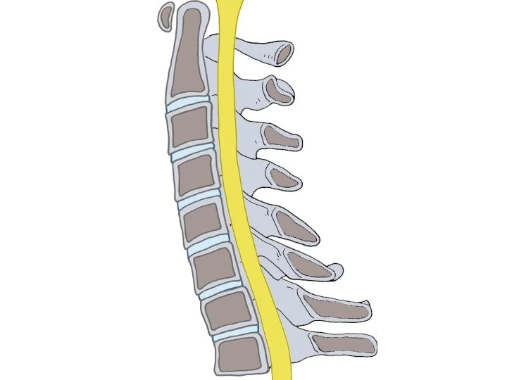 Flexion Distraction (COX) Technique - Spinal Decompression — Movement ...