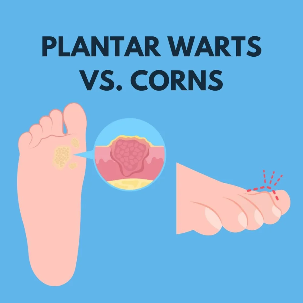 Blog | Relief Podiatry