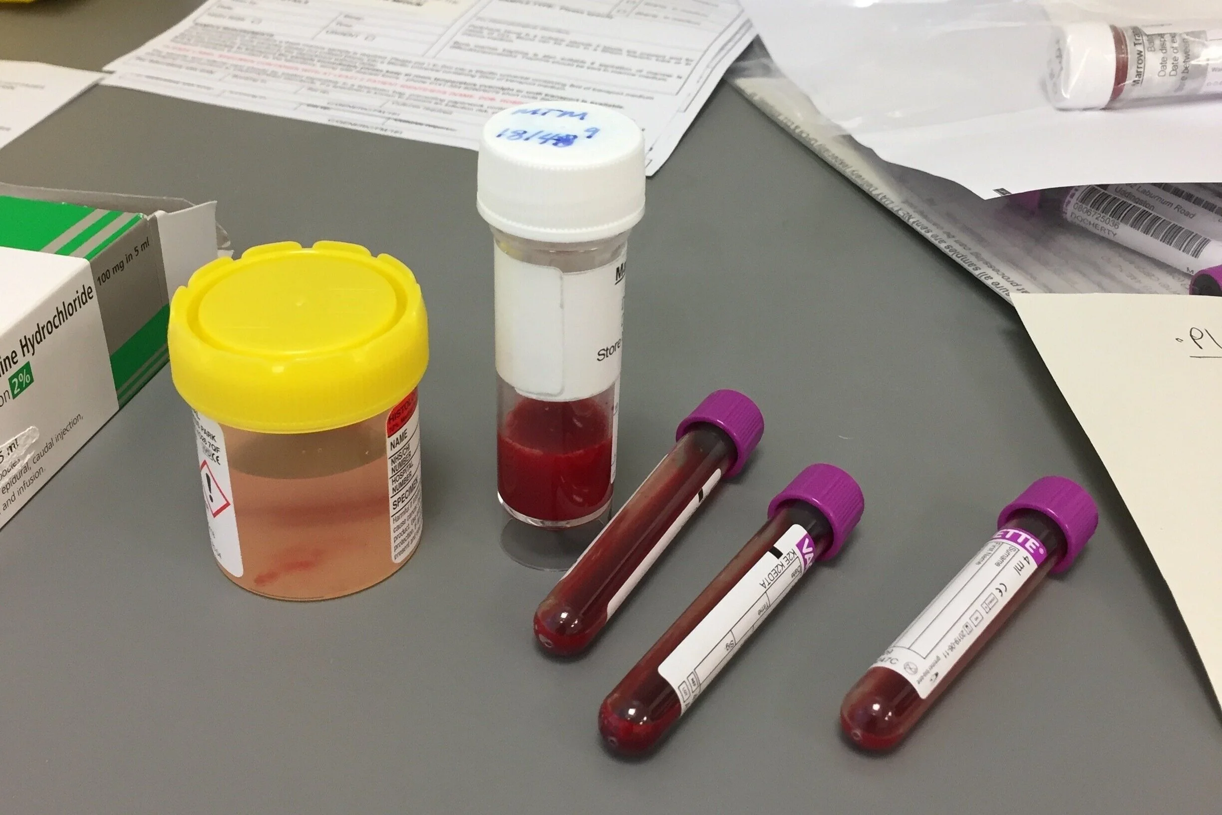 3 Years Cancer Free - Part 2 — Oldmangrey.com