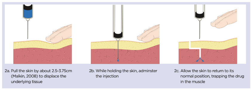 Episode 167: Long-Acting Injectables with Dr. Cummings — Psychiatry ...