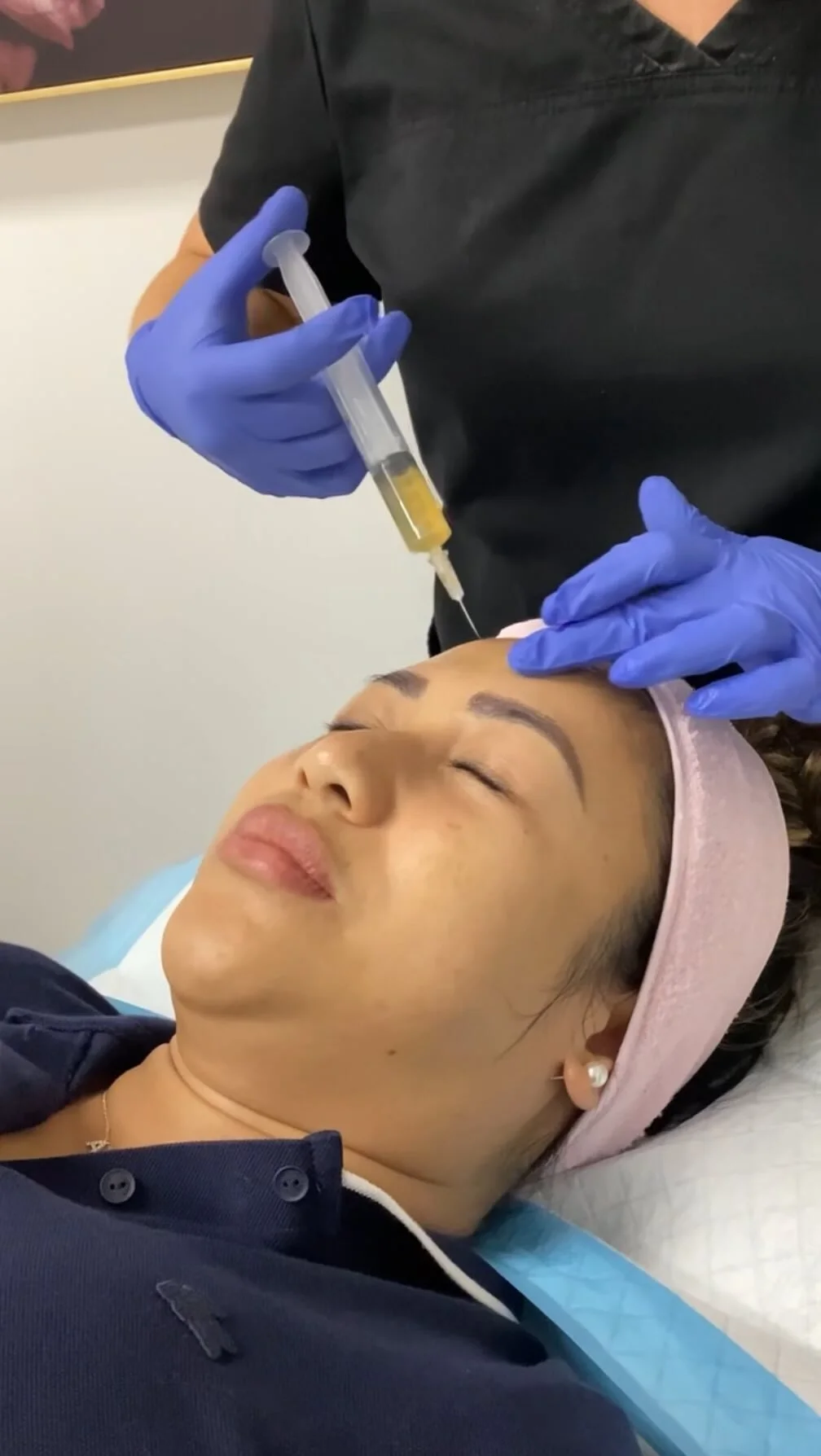 Dermal Fillers Brisbane | Cosmetic Filler Treatment | Sonder Private ...