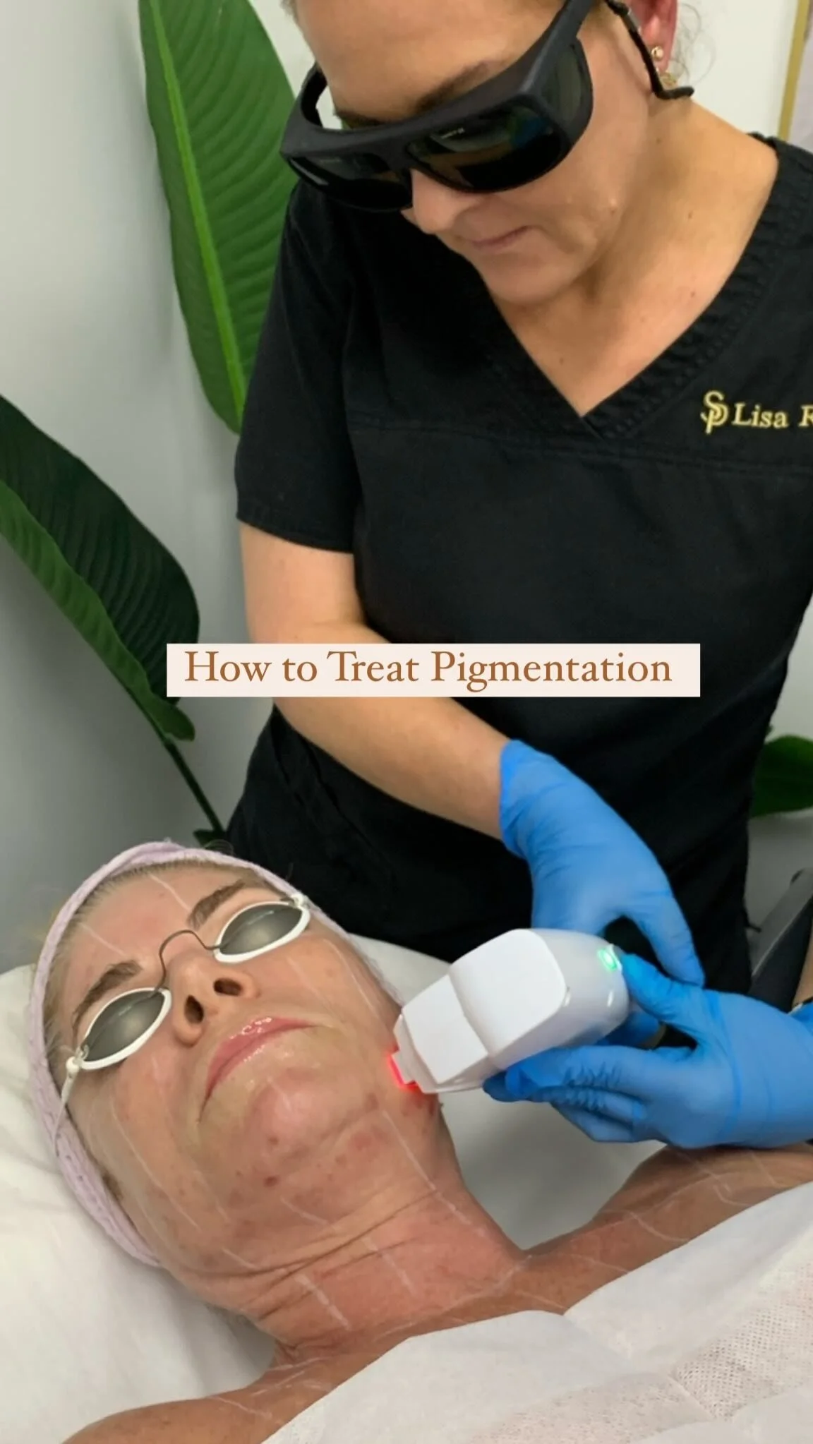 Dermal Fillers Brisbane | Cosmetic Filler Treatment | Sonder Private ...