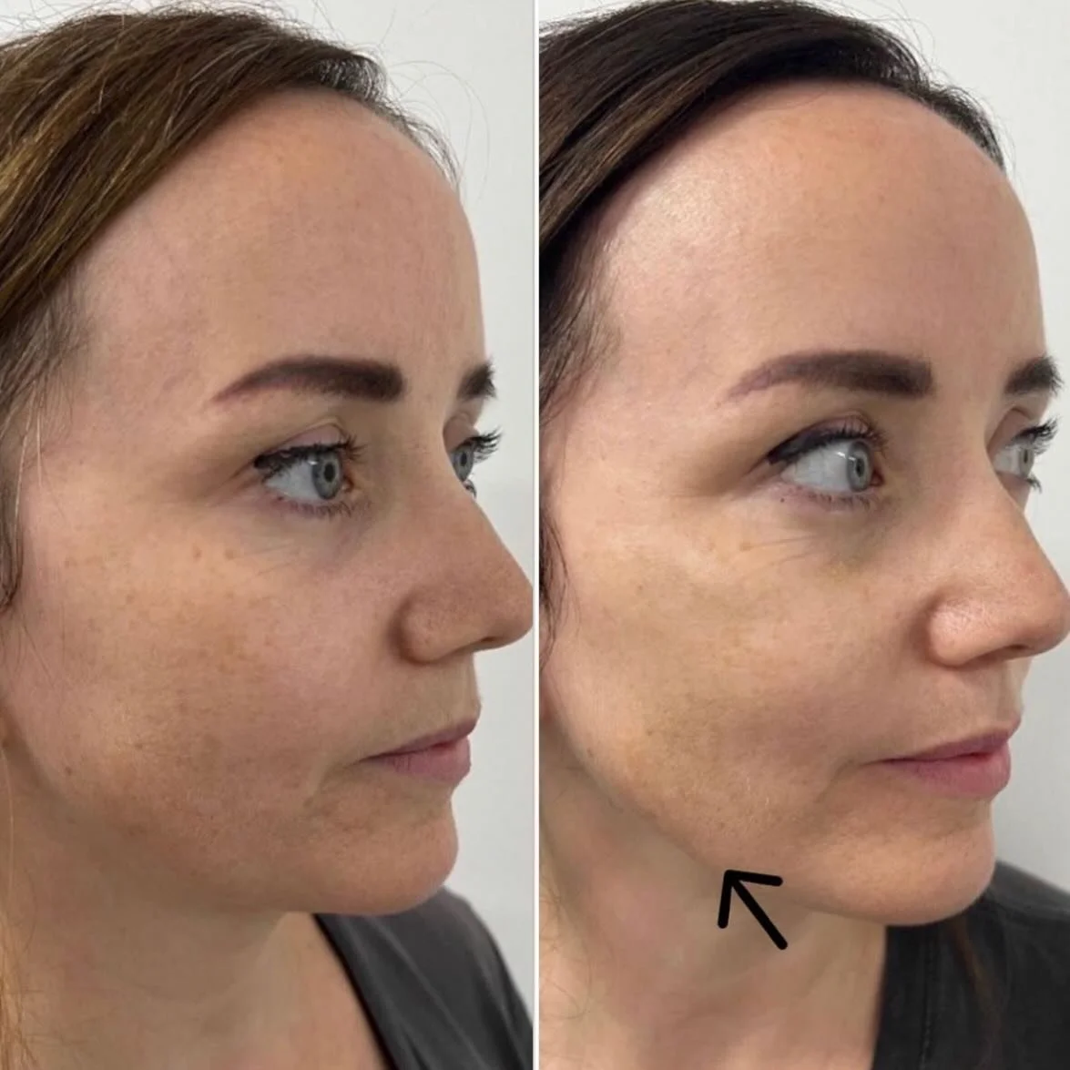 Brisbane Clinic Offering expert Cosmetic, Medical and Skin Treatments ...