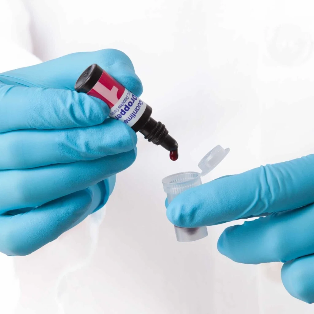 HbA1C liquid QC Diabetes Quality Control - Quantimetrix — Sterilab ...