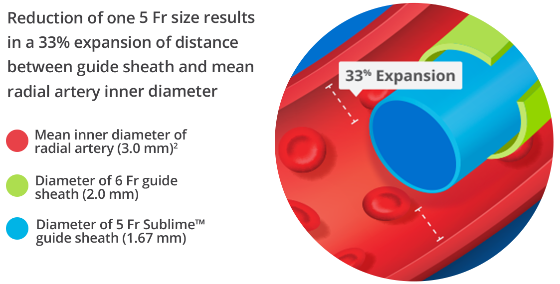 Sublime™ Radial Access Guide Sheath — Sublime™ Radial Access Platform