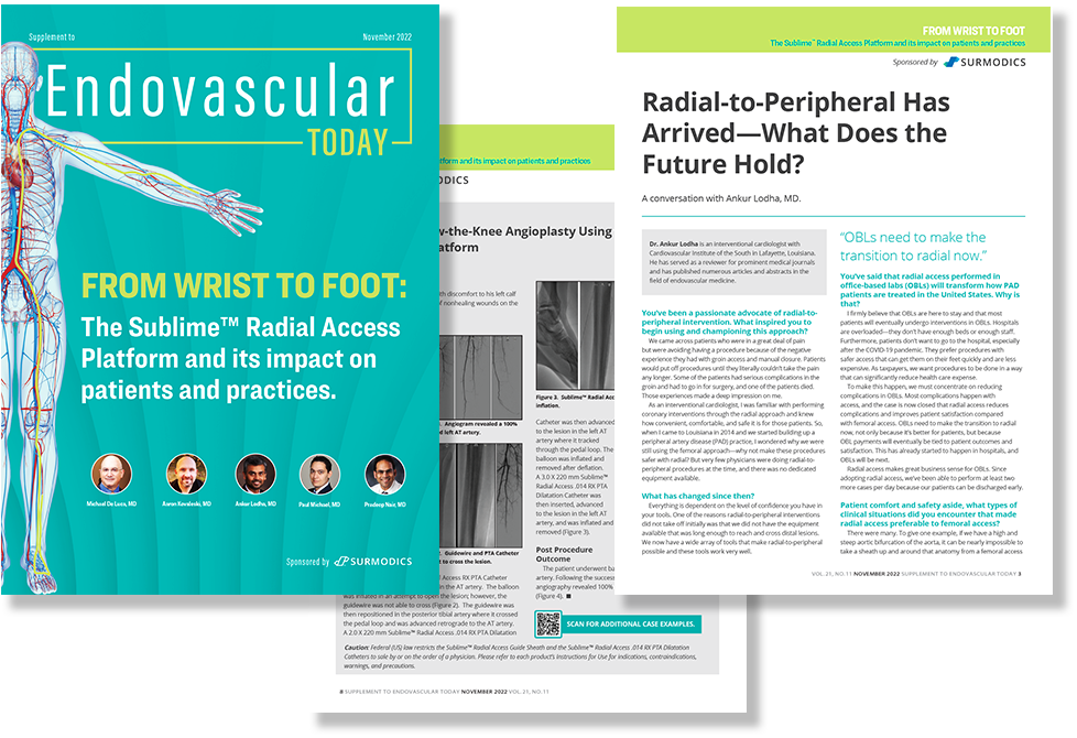 Sublime™ Radial Access Platform