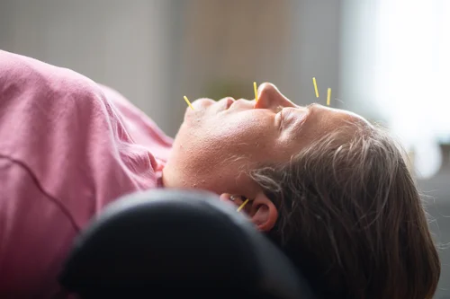 How Dry Needling Can Relieve Muscle Pain and Tension — Wildflower ...