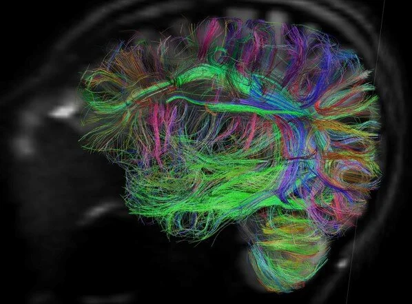 Brain Networks — Paradigm Psychiatry
