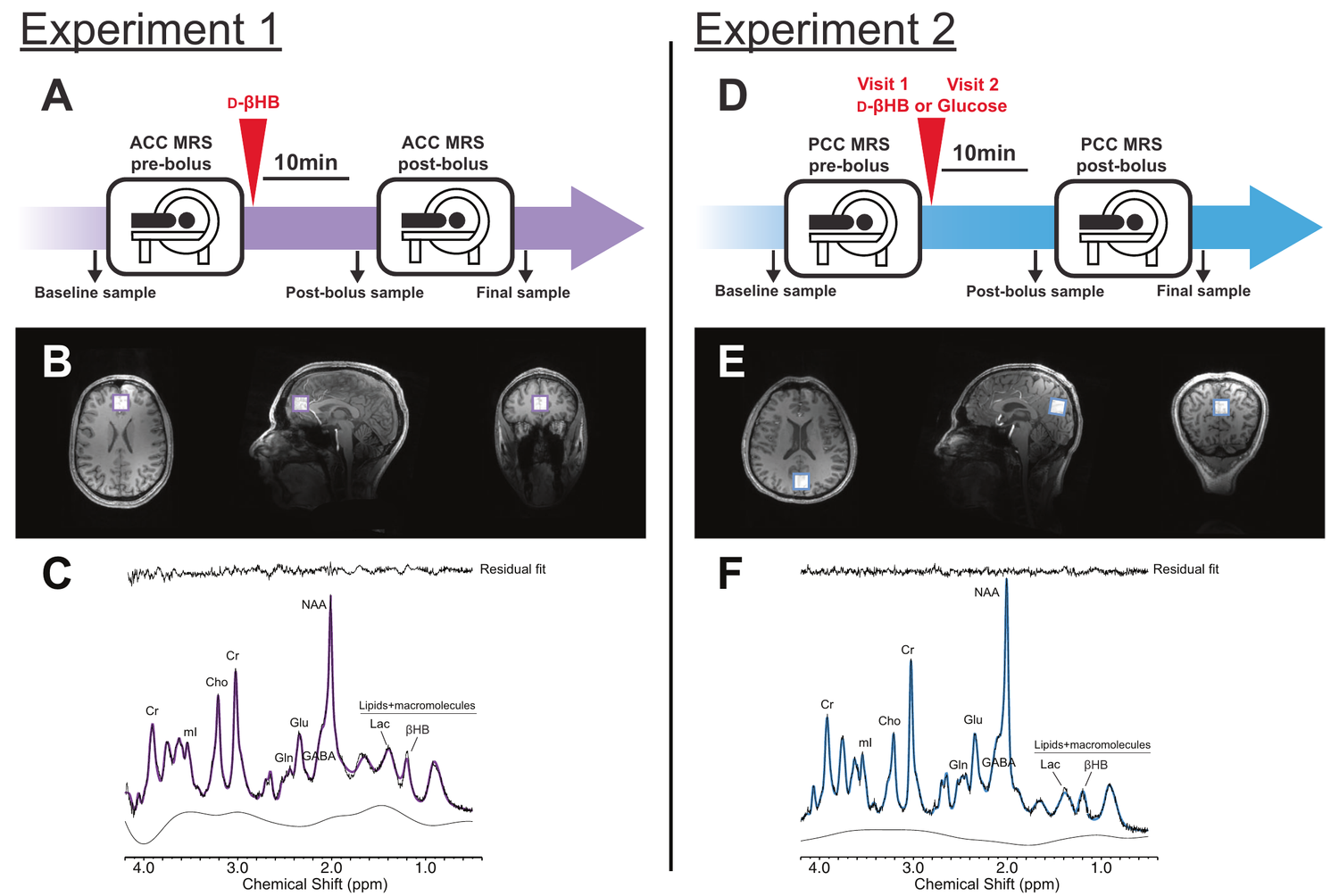 Acute administration of ketone beta-hydroxybutyrate downregulates 7T ...