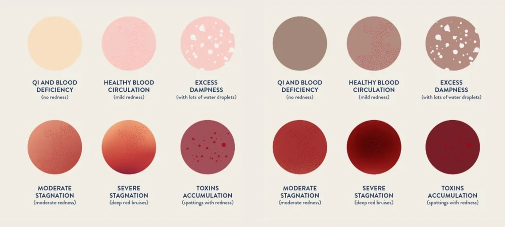 Massage — Intuit Healing