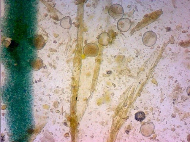 UNDER THE MICROSCOPE — Eggzamin