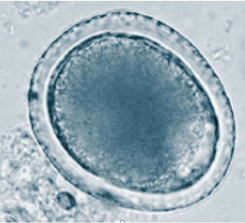 IDENTIFYING INTERNAL PARASITES IN CATTLE — Eggzamin™ Top-Rated FEC ...
