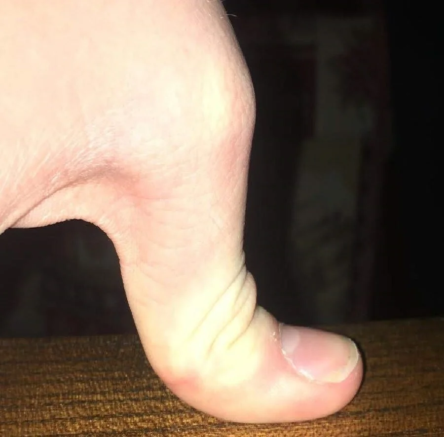 Thumbs Up for Shiatsu — Tamsin Grainger