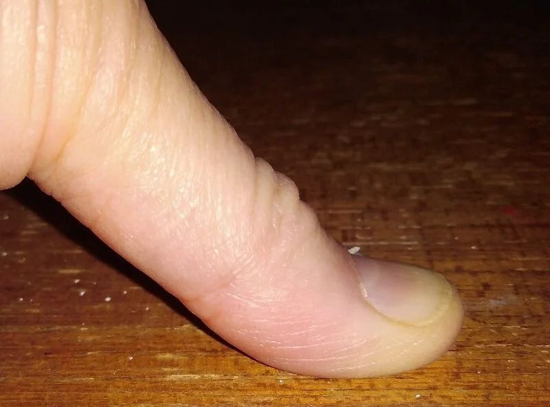 Thumbs Up for Shiatsu — Tamsin Grainger