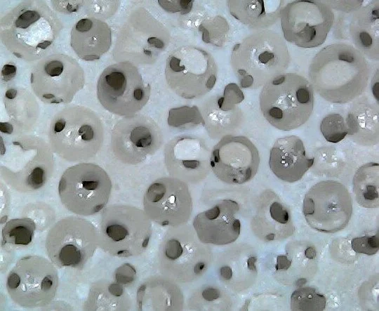 About — Porous PEEK