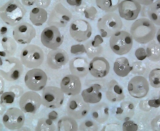 About — Porous PEEK