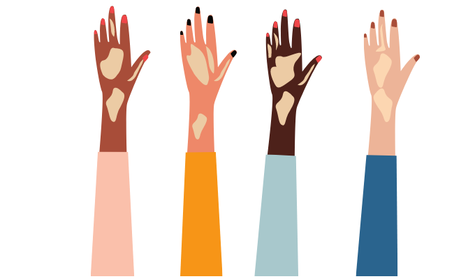 Dusky Skin Color Medical