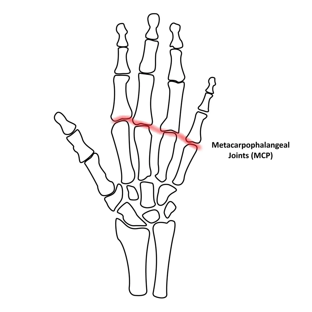What is the MCP Joint? — Joint Active Systems