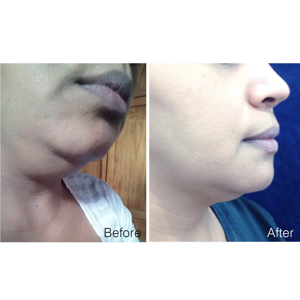 celluformplus gallery — Celluform