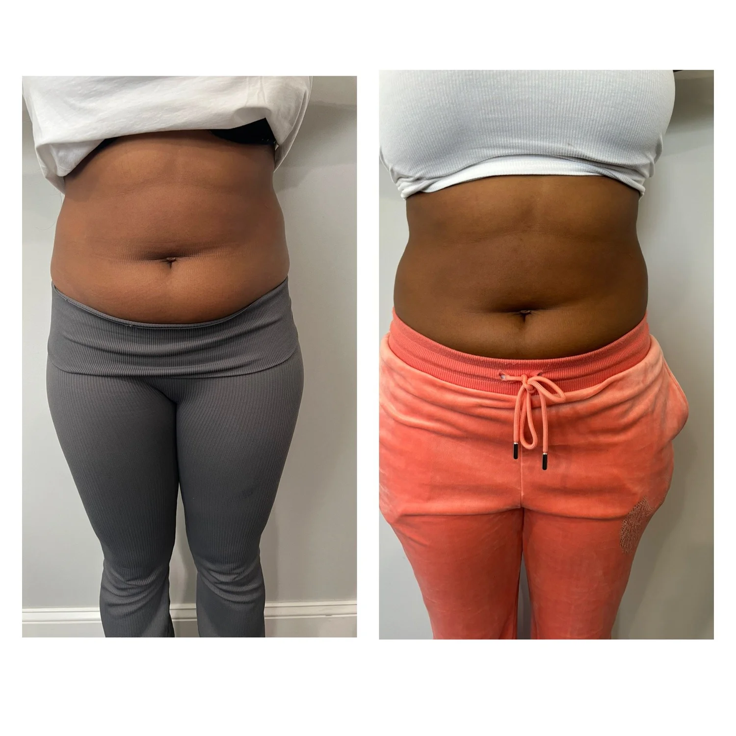 Drip Station DMV Aesthetics — Drip Station DMV