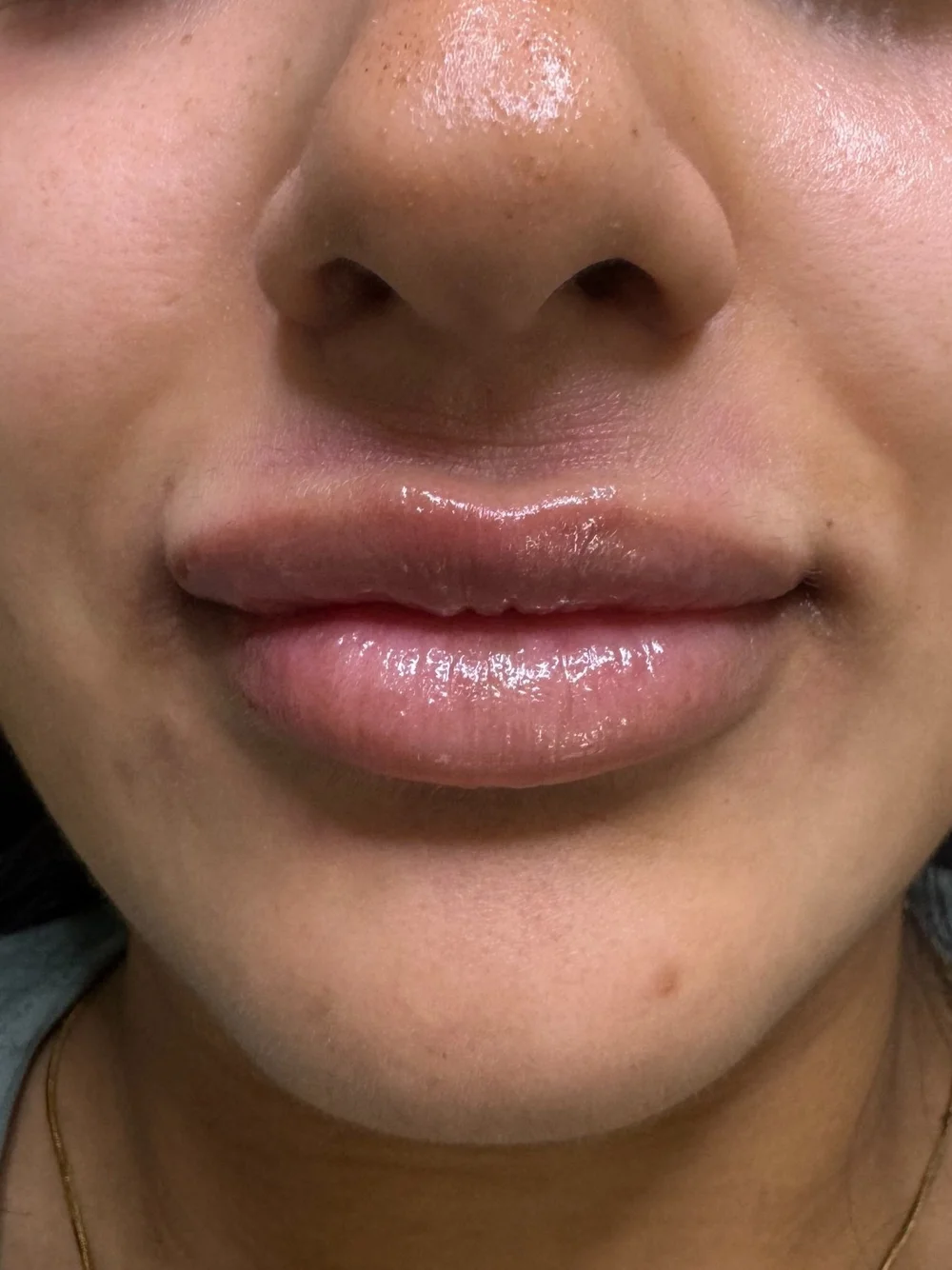 Drip Station DMV Aesthetics — Drip Station DMV