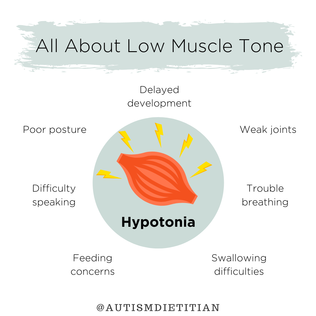 Hypotonia (Low Muscle Tone) — Autism Nutrition Library