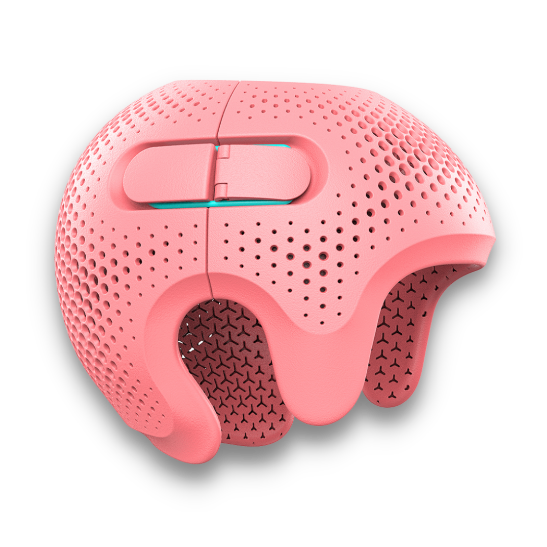Tiny Wonders custom pediatric bracing and cranial remolding helmets in ...
