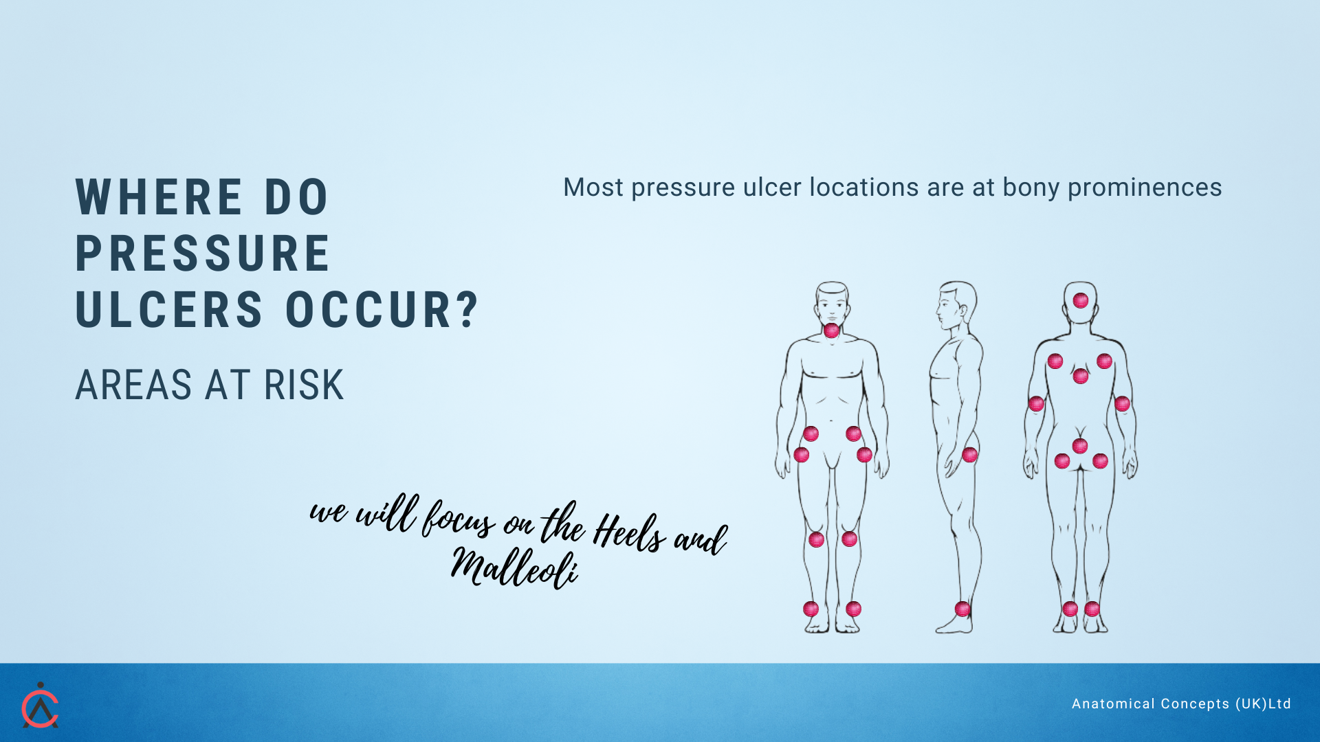 Why the PRAFO Range of Ankle Foot Orthosis Is the Market Leader ...