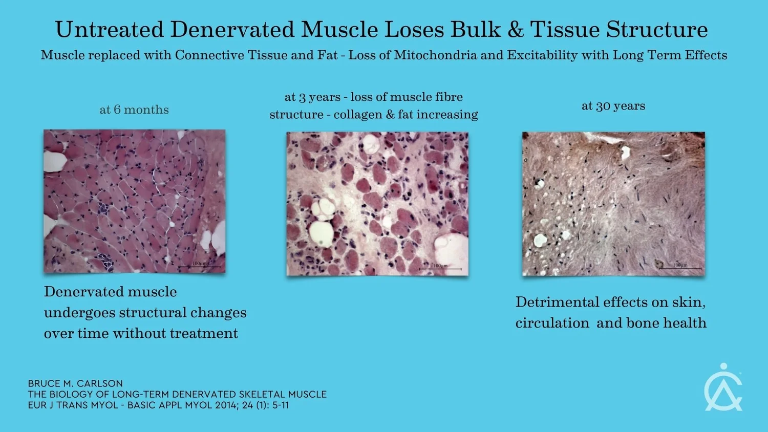 Can Electrical Stimulation Help Denervated Muscles Recover ...