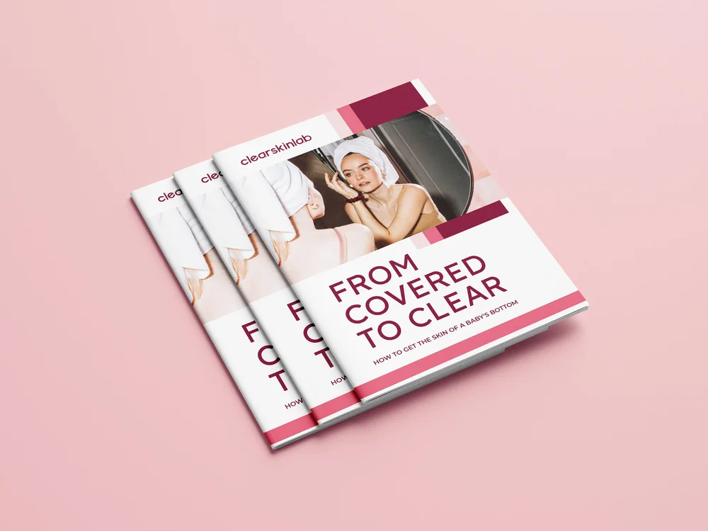 Acne Guide — The Clear Skin Lab