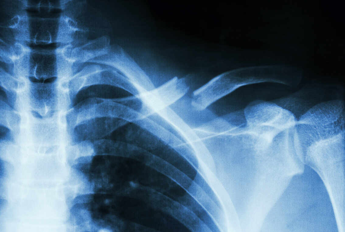 Orthopaedic Trauma Surgery Wangaratta — James Churchill | Orthopaedic ...