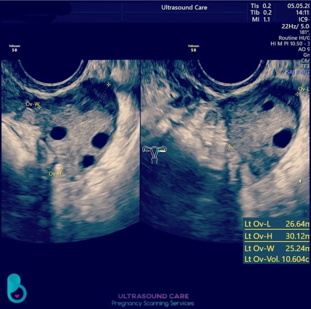 Baby Scan Liverpool - Affordable Price with Quality Service