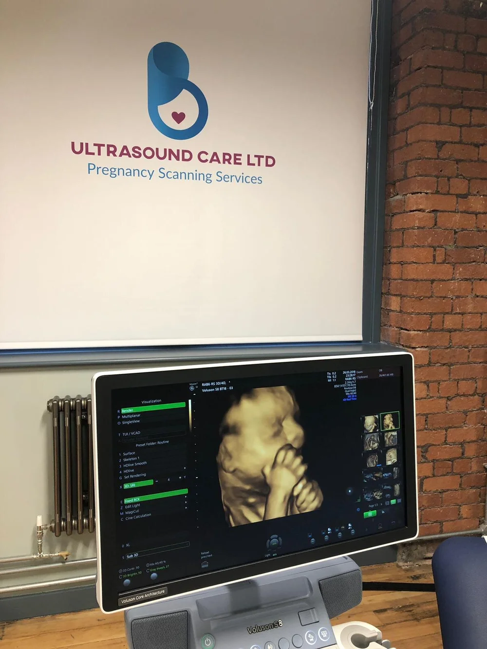 Baby Scan Liverpool - Quality Scans From £59 Only