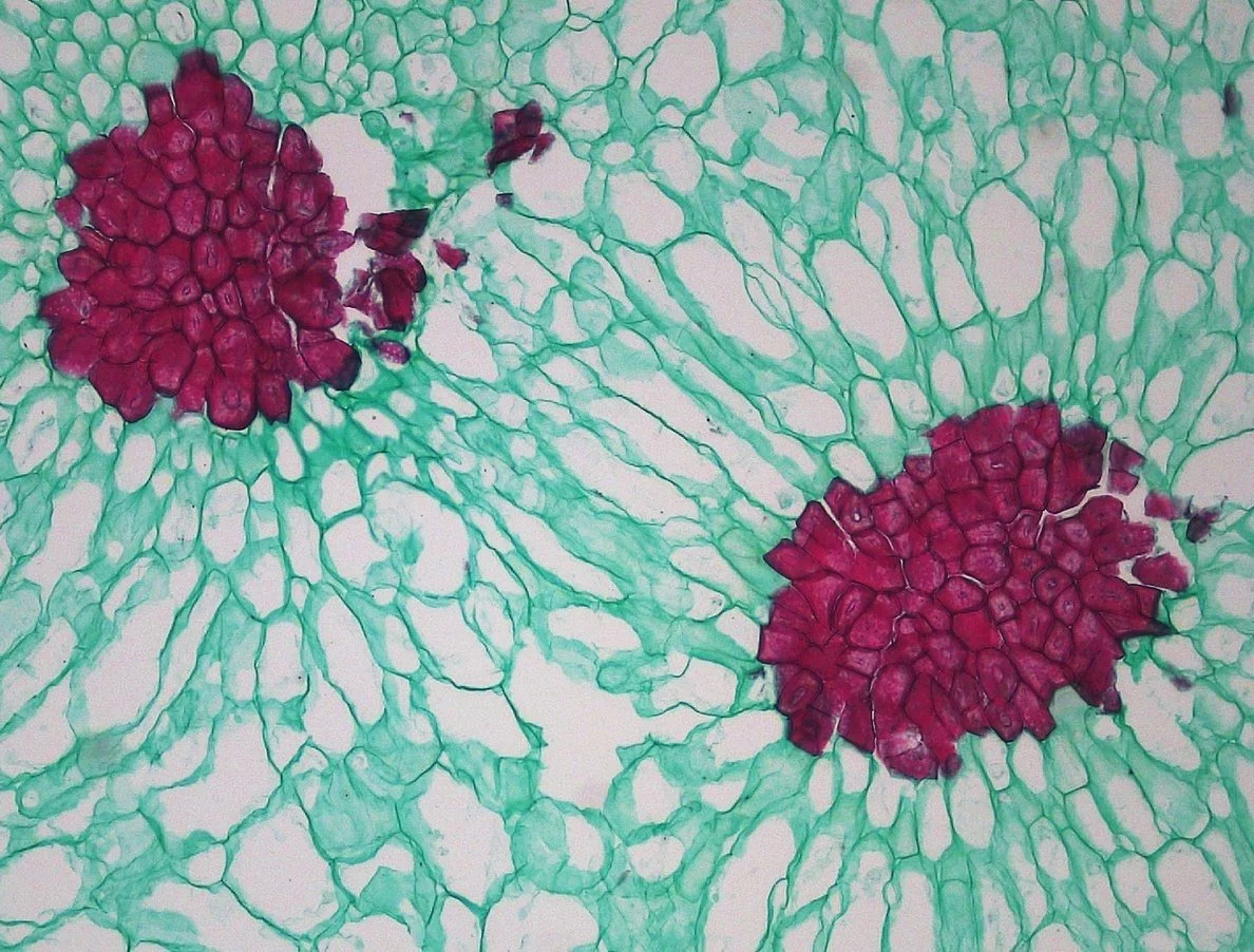 Why so Gritty? — Hundredfold Video | Video Production Studio in St ...