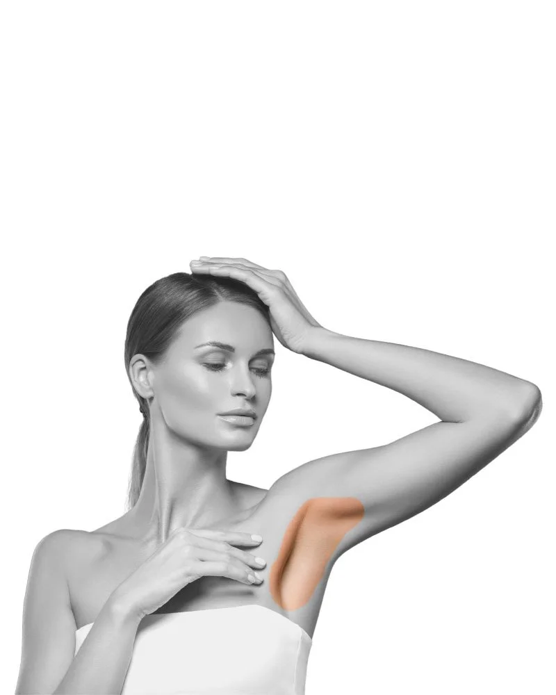 Laser Hair Removal Buy Online — Cara Derma Skin & Laser Clinic