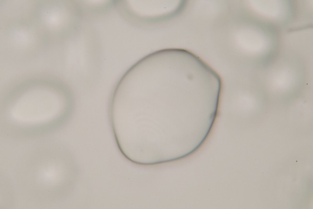 Starch Gelatinization Under the Microscope — San Francisco ...