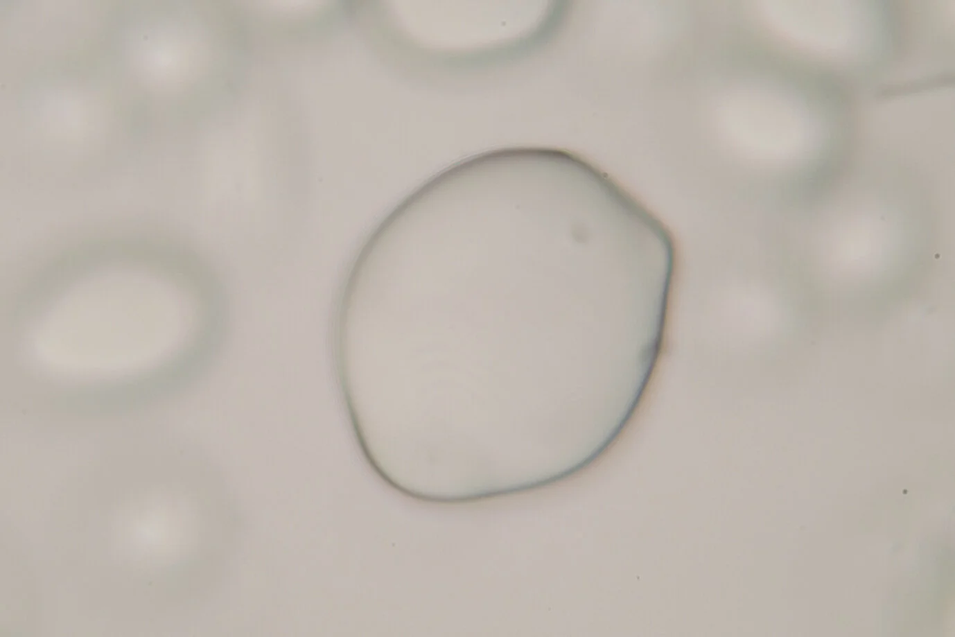 Starch Gelatinization Under the Microscope — San Francisco ...