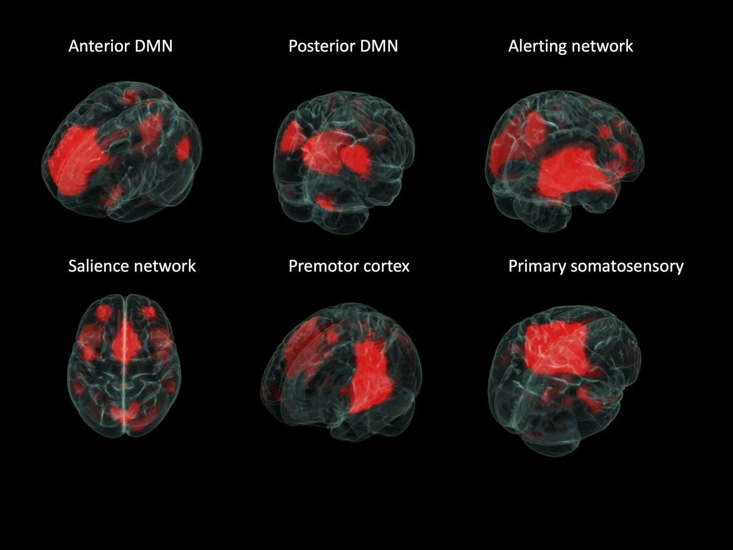 Seizures — Epilepsy Canada Épilepsie