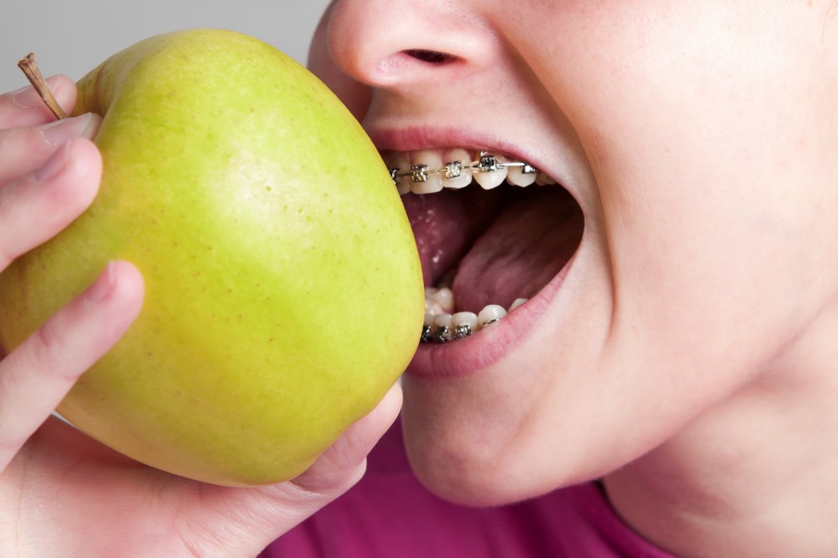 25 Healthy Snacks to Eat with Braces — Ready Set Grow